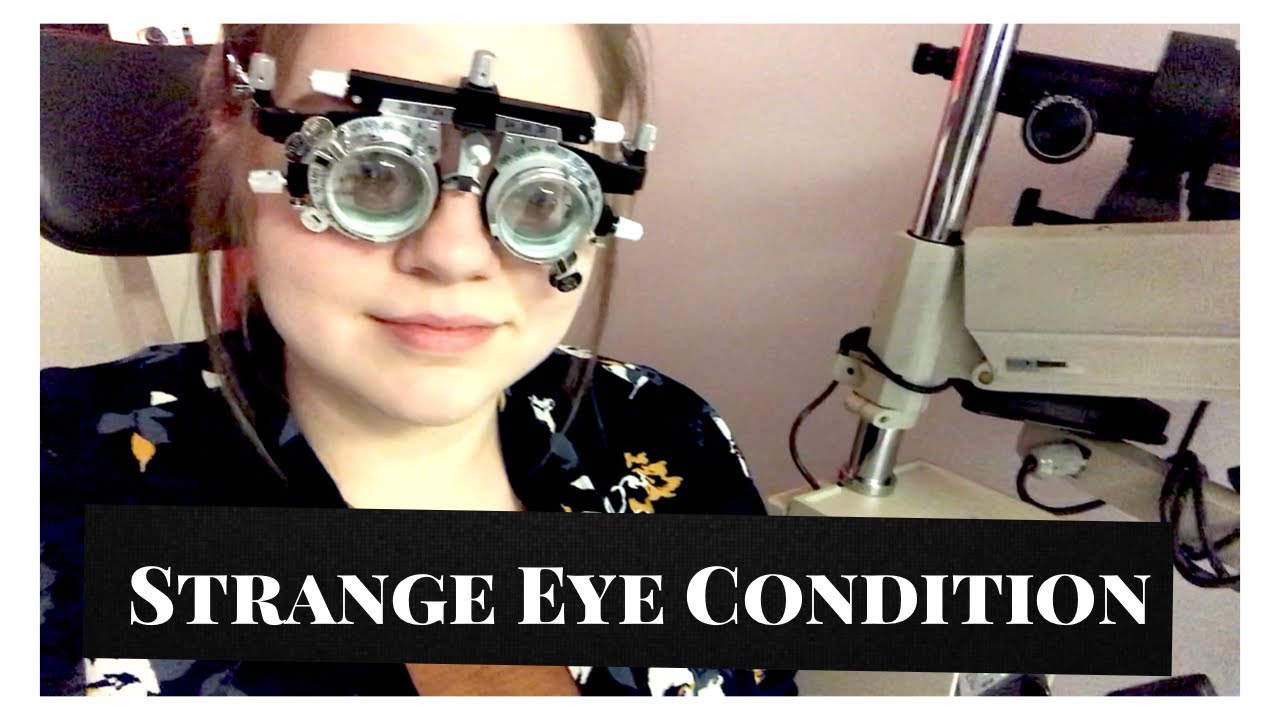 Doctor Visit | Strange eye condition | Gas Perm Contacts - YouTube