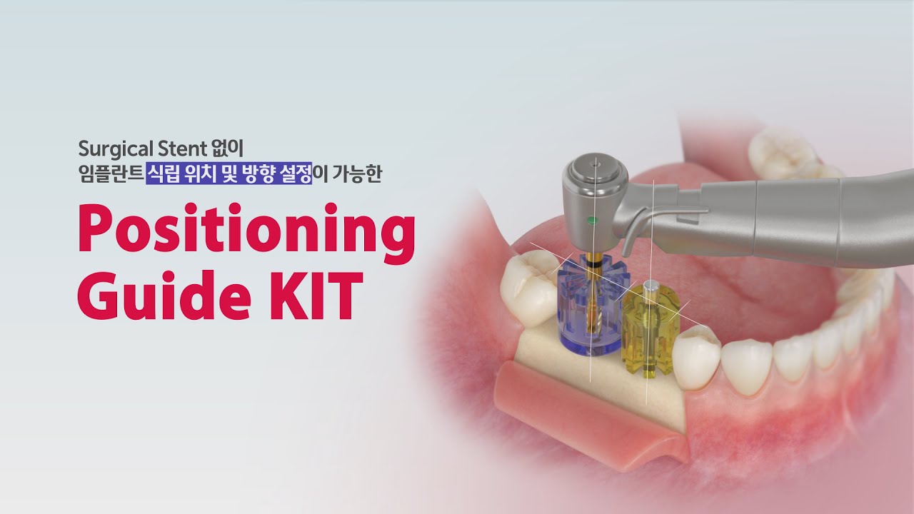 [KIT] Positioning Guide KIT_서지컬 스텐트 없이 임플란트 식립 위치 및 방향 설정이 가능한 KIT ...