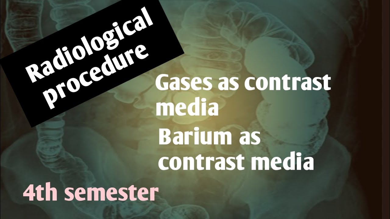 #gases // barium //contrast media//radiological procedure //radiology ...