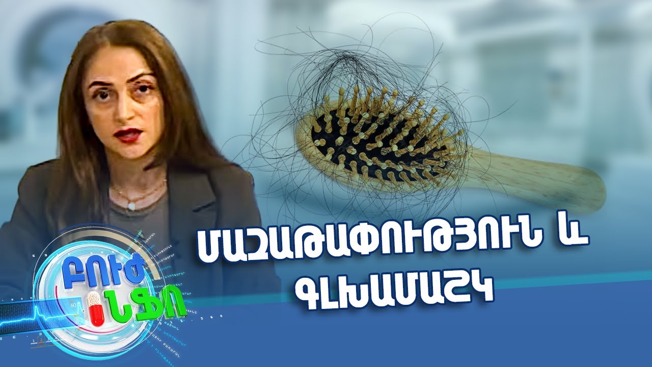 Մազաթափություն և գլխամաշկ / Խորհուրդ մասնագետից / Բուժ ինֆո / Buj Info ...
