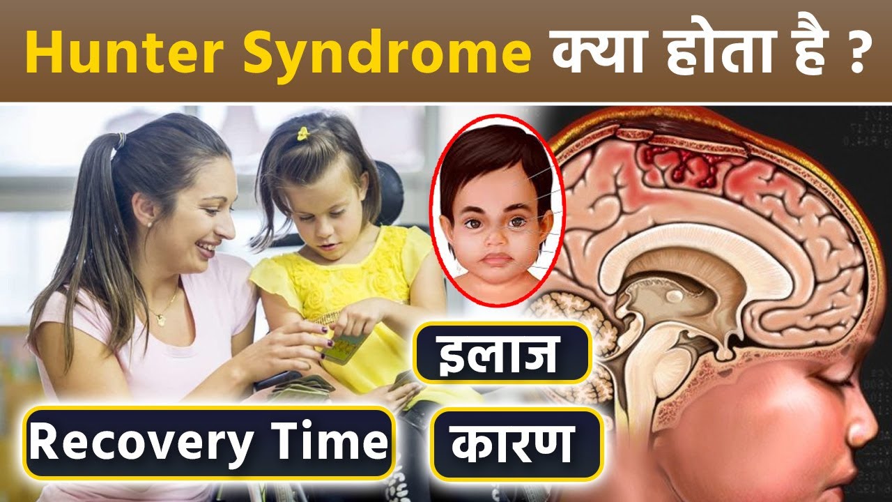 Hunter Syndrome Causes, Symptoms, Treatment, Recovery Time...| Boldsky ...