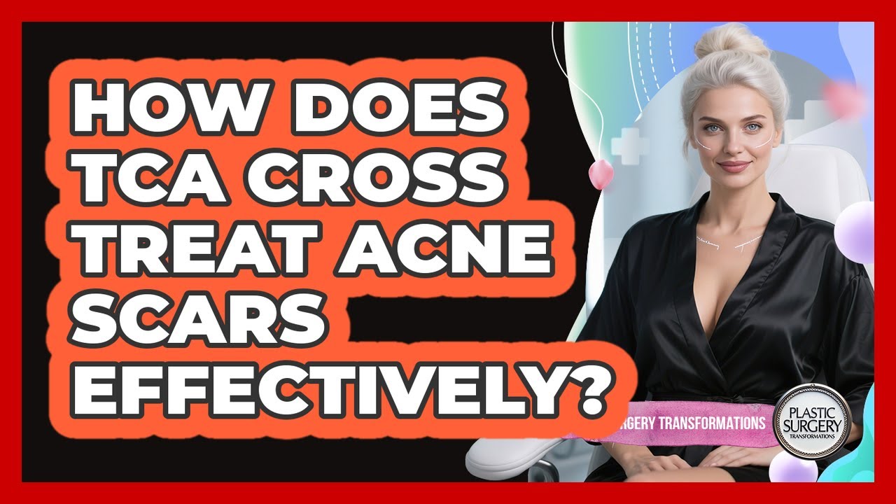 How Does TCA Cross Treat Acne Scars Effectively? - Plastic Surgery ...