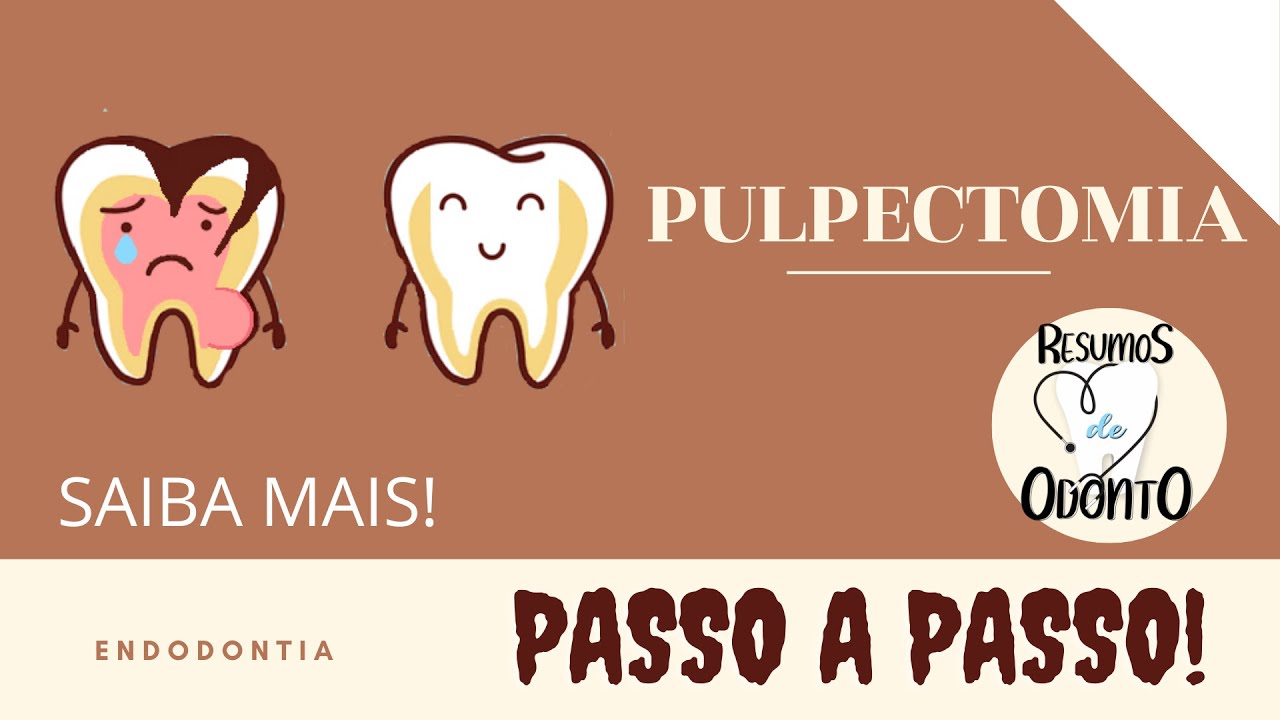 Pulpectomia Passo A Passo - LIBRAIN Pulpectomia Passo A Passo - LIBRAIN