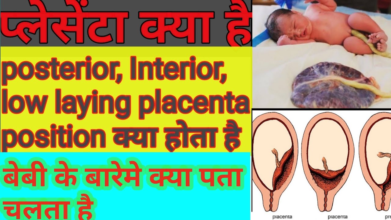 what is placenta, position, grading,maturity level, posterior(boy ...