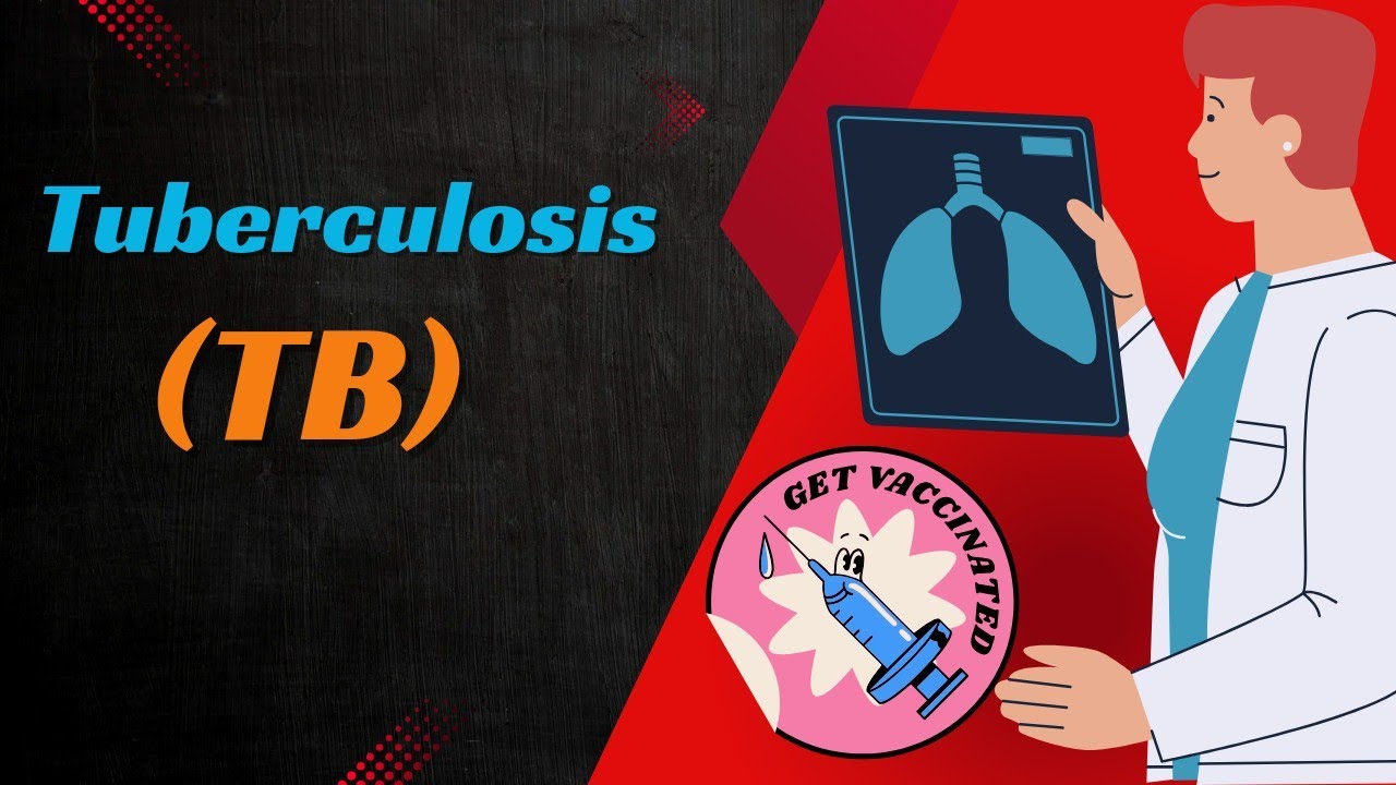 TUBERCULOSIS/ MUST WATCH VIDEO - YouTube