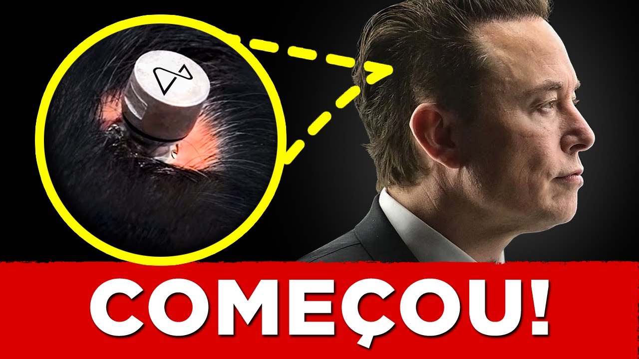 PRIMEIRO CHIP IMPLANTADO NO CÉREBRO HUMANO COMEÇARÁ EM BREVE - YouTube