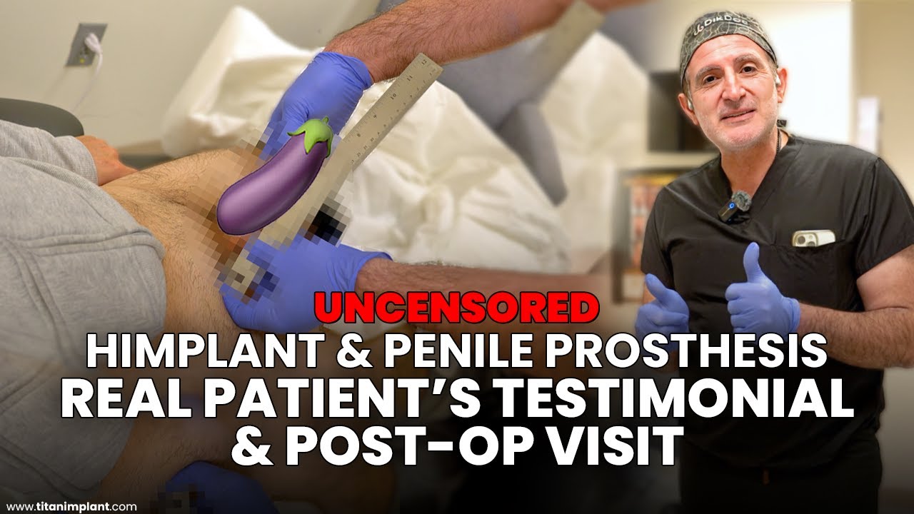 SHOCKING RESULTS! Penile Prosthesis and Himplant® Penuma Real Patient ...