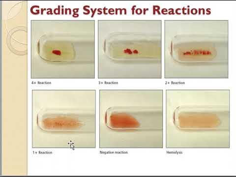 ABO Blood Grouping: Forward and Reverse Grouping - YouTube