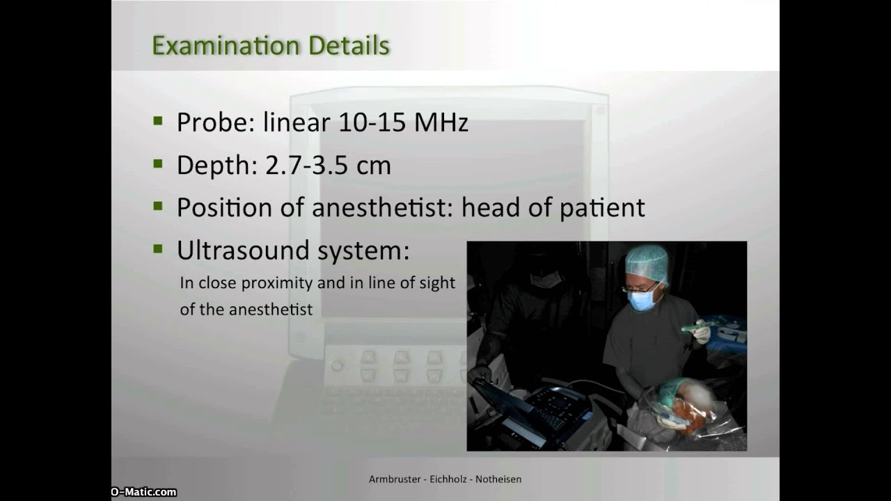 Cervical Plexus Block - Needle Insertion Approach - YouTube