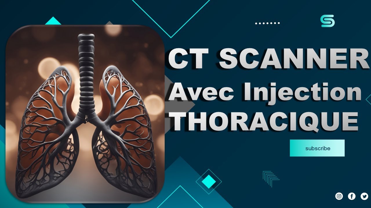 CT Scanner THORACIQUE (Avec Injection) - Partage de Pratiques - YouTube