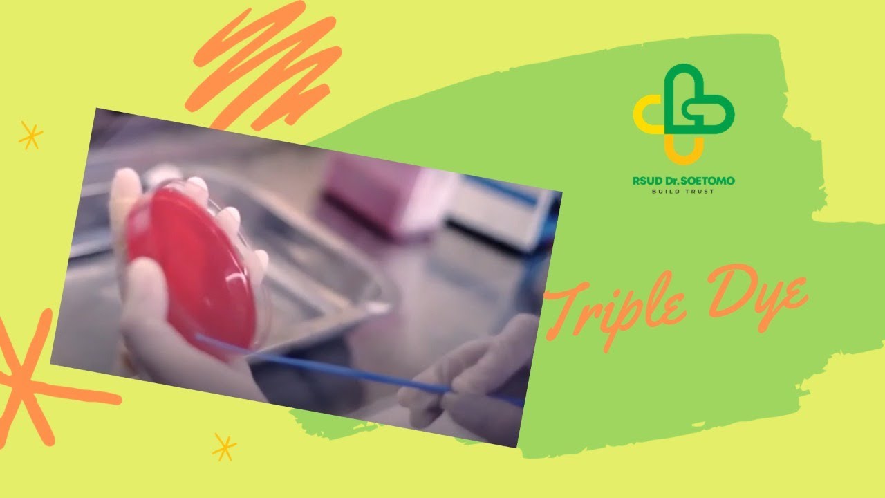 VIDEO TRIPLE DYE SOETOMO - YouTube