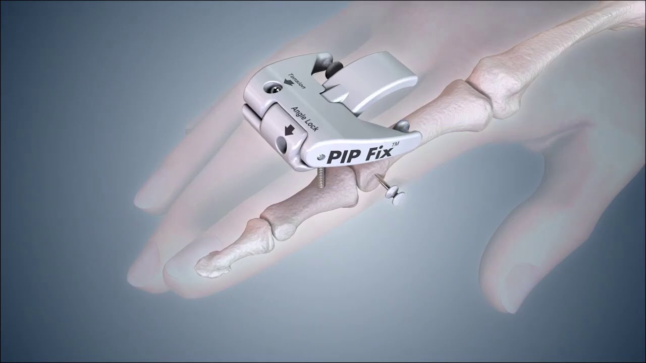 Hand Biomechanics Lab - Narrated by Debbie Irwin - YouTube