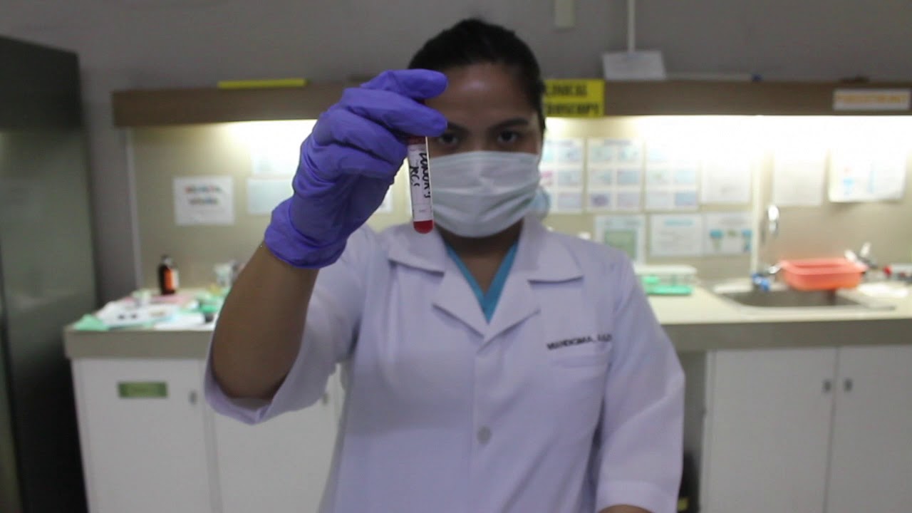 MAJOR CROSSMATCHING GEL METHOD - YouTube