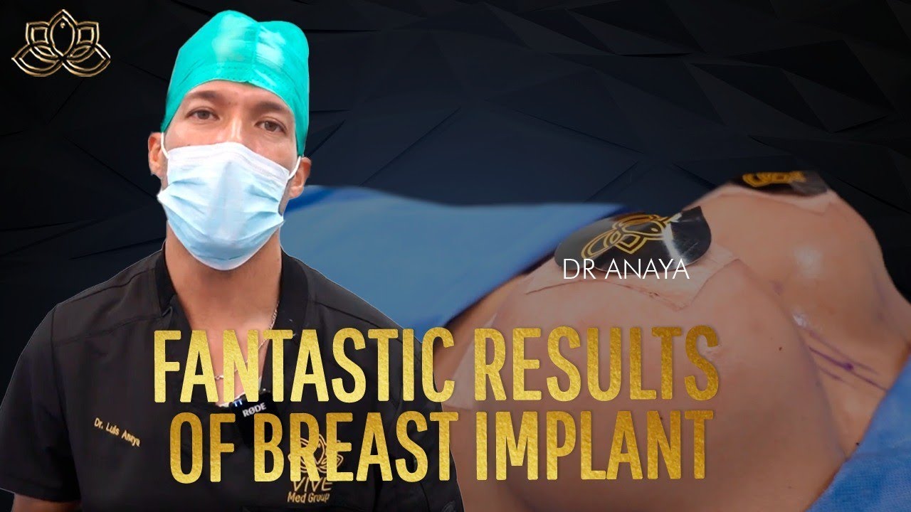 The perfect Breast Augmentation! Pexia + Breast Implants by Dr Anata ...