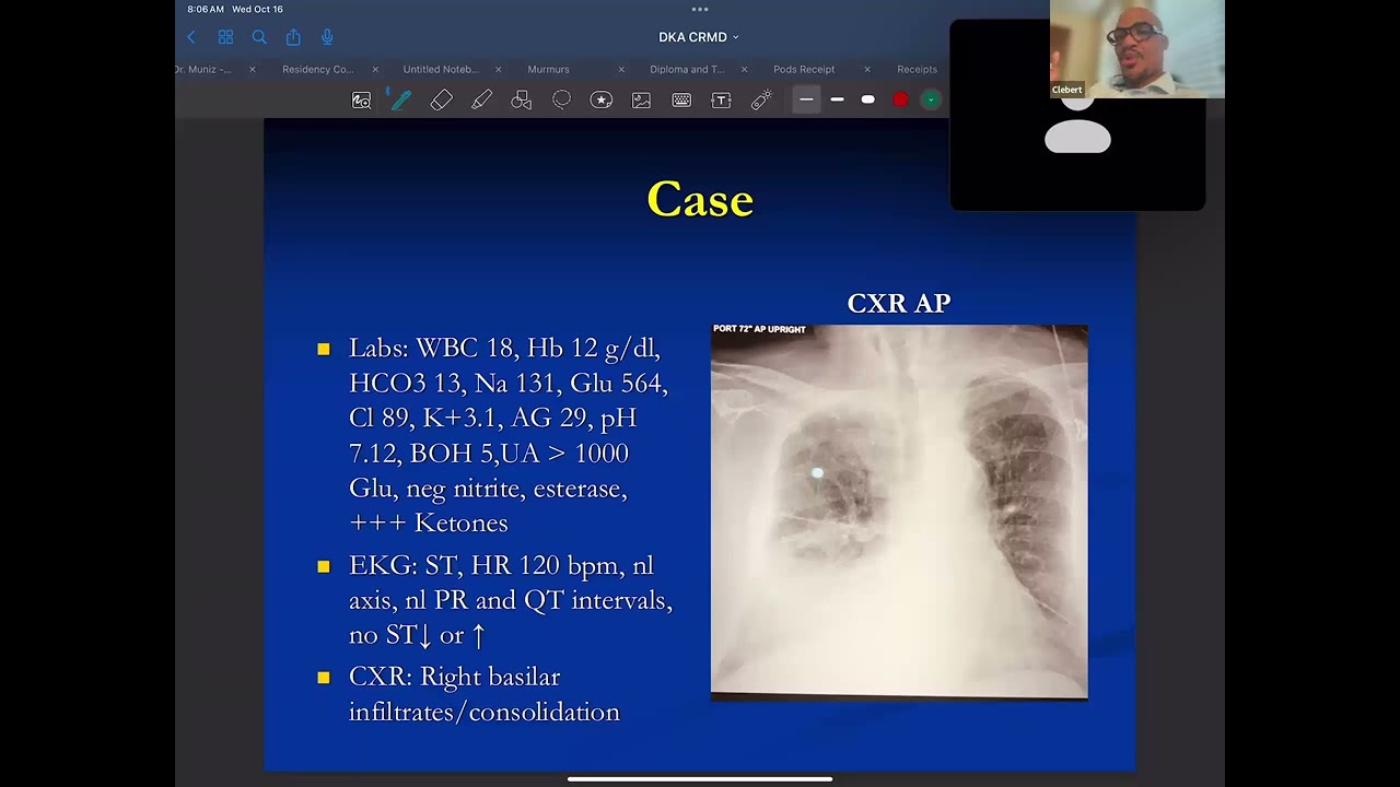 10/06/24 Dr. Isma Clebert Junior – Diabetic ketoacidosis - Diabetes