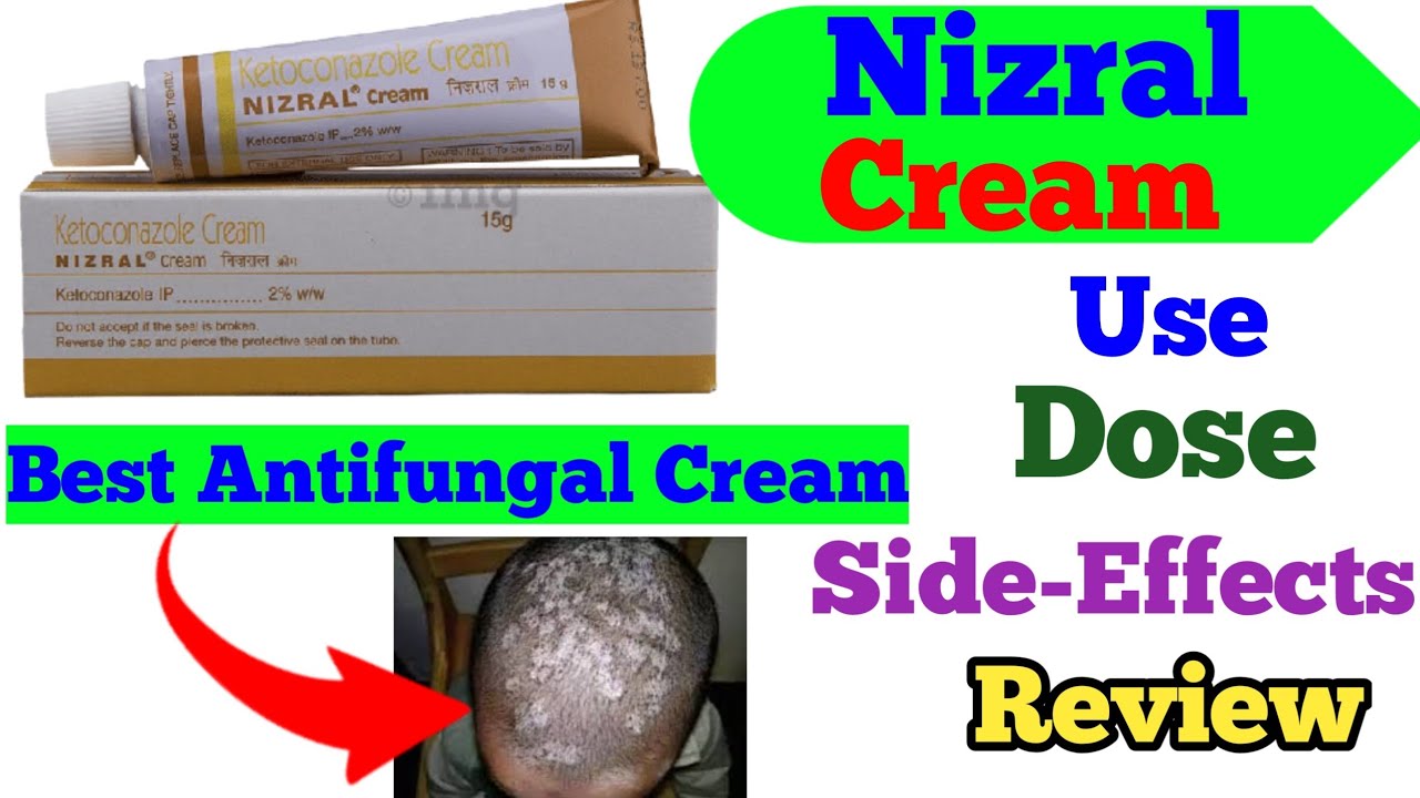 Nizral Cream Use Dose Side-Effects Precautions And Review - YouTube
