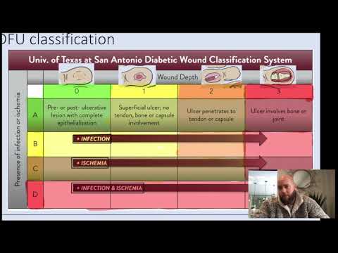 University of Texas Classification of Diabetic Ulcers - YouTube