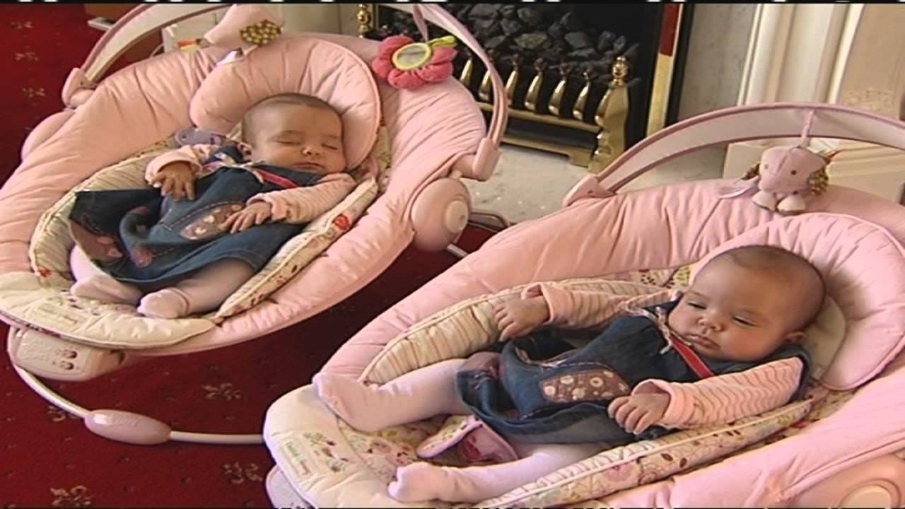 The Most Amazing Conjoined Twins - YouTube