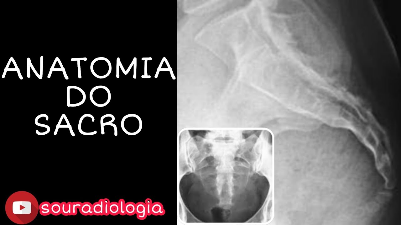 Anatomia do sacro (Radiologia) - YouTube