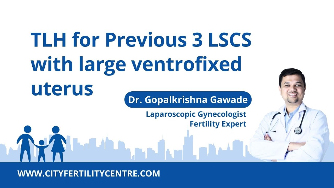 Total Laparoscopic Hysterectomy for Previous 3 LSCS with large ...