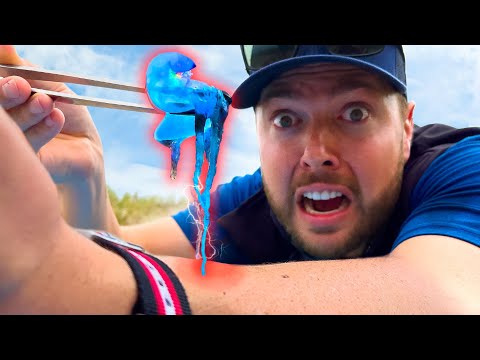 STUNG by PAINFUL JELLY!