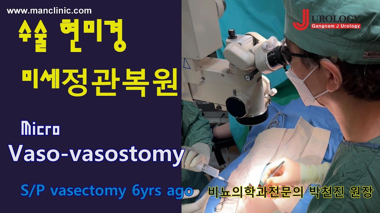 수술현미경 미세정관복원 - Micro Vaso-vasostomy S/P vasectomy 6yrs ago - YouTube