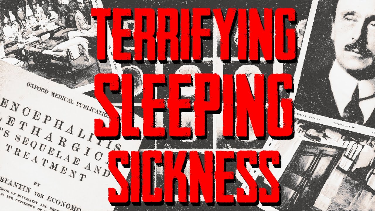 Encephalitis Lethargica - The Sleeping Sickness - YouTube