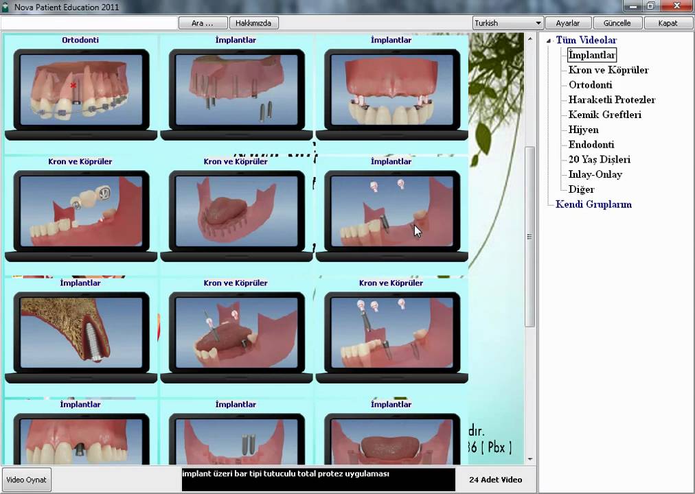 NovaSoft Dental Patient Education 3D Animation Software for Dentist ...