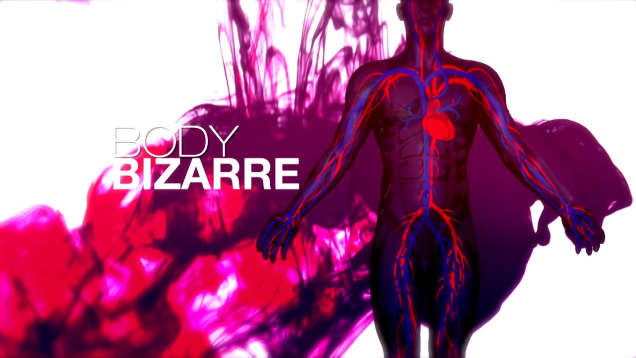 Il a une tumeur de 60kg entre les jambes ! (Body Bizarre) - YouTube