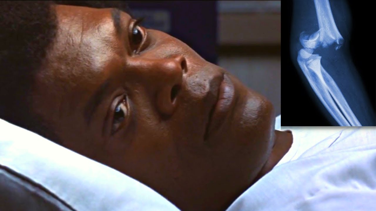 Man Whose Bones Are Made Of Glass Searches For A Miracle | Movie Recap ...