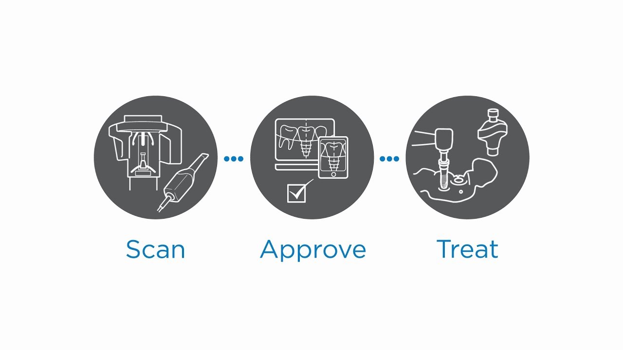 Azento digital implant workflow animation - YouTube
