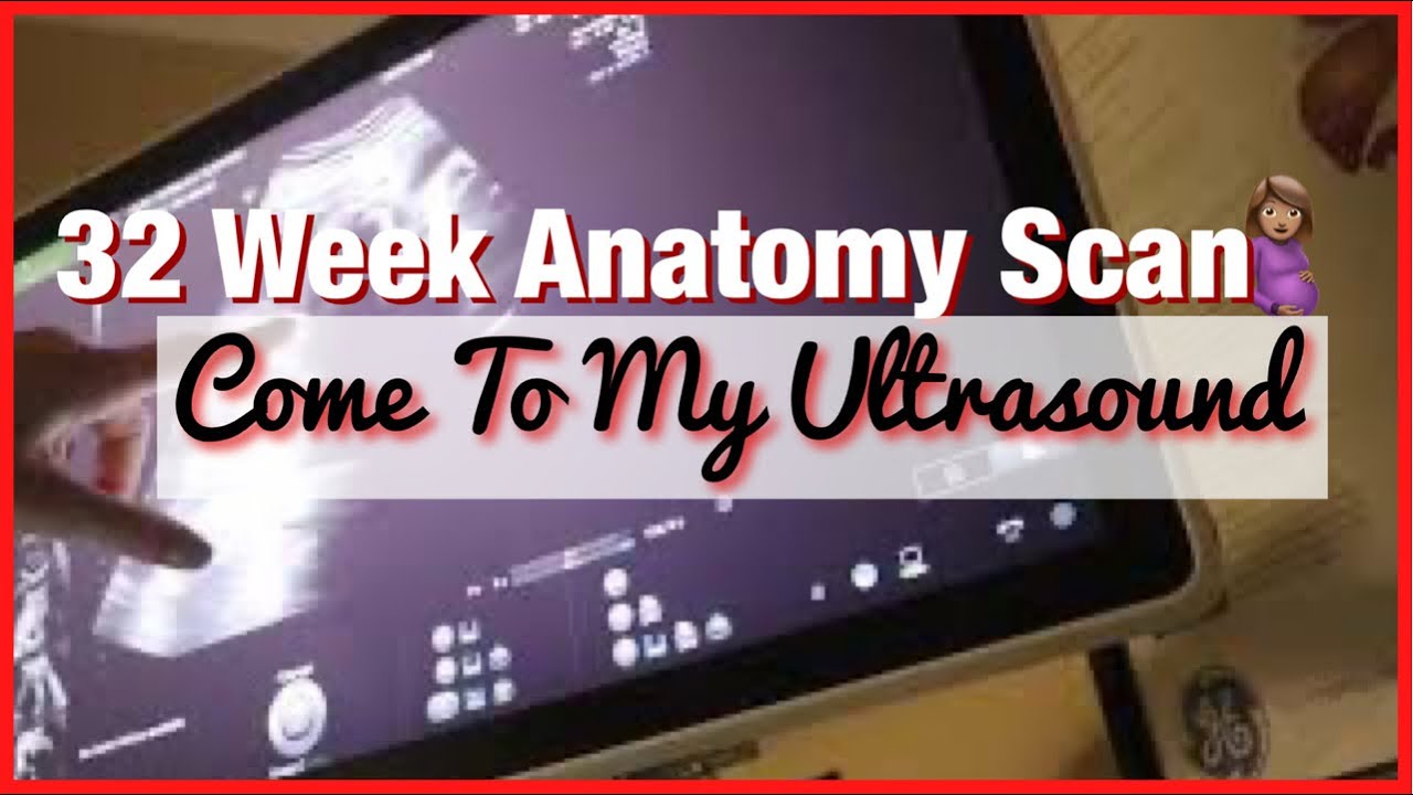 32 Week Update | Baby Anatomy Scan | Is The Baby Okay? - YouTube