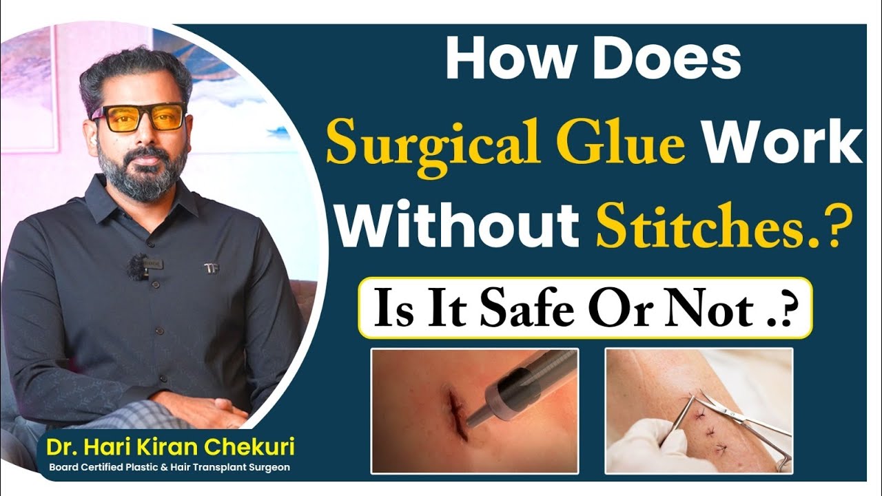 How Surgical Glue Works Without Stitches | Advanced Wound Closure ...