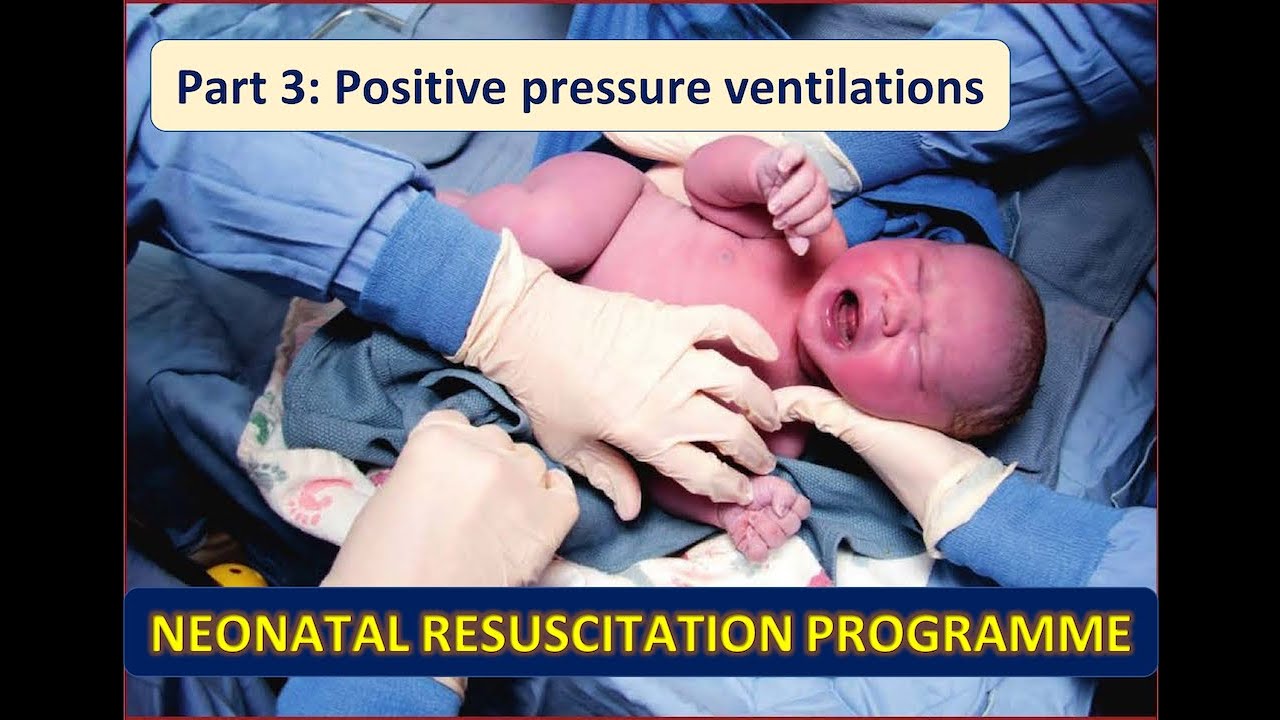 Neonatal Resuscitation Program | Part 3 | Positive pressure ventilation ...