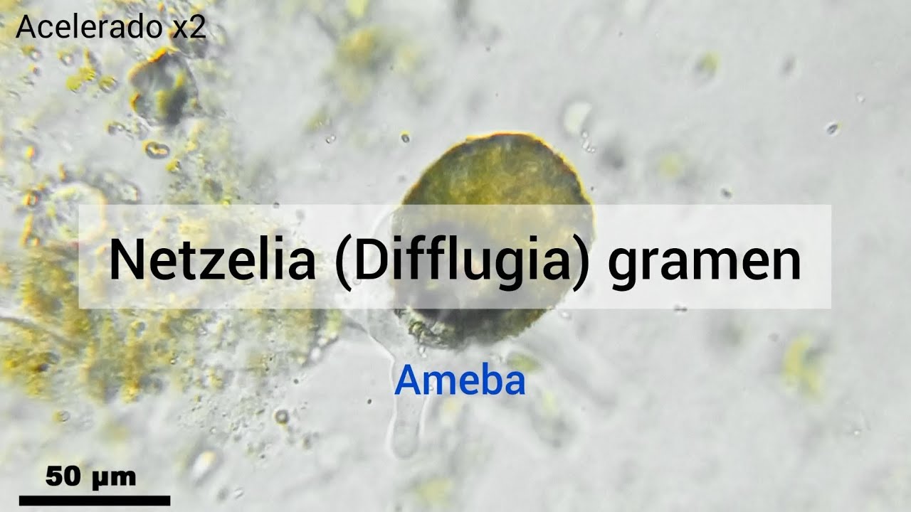 Netzelia (Difflugia) gramen (Ameba) - YouTube