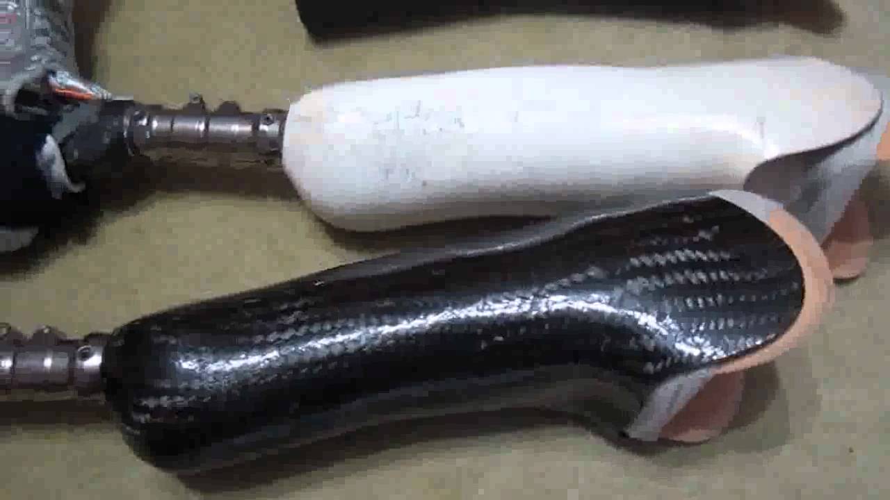 Stompers- Double Amputee Slippers compared to prosthetics - YouTube