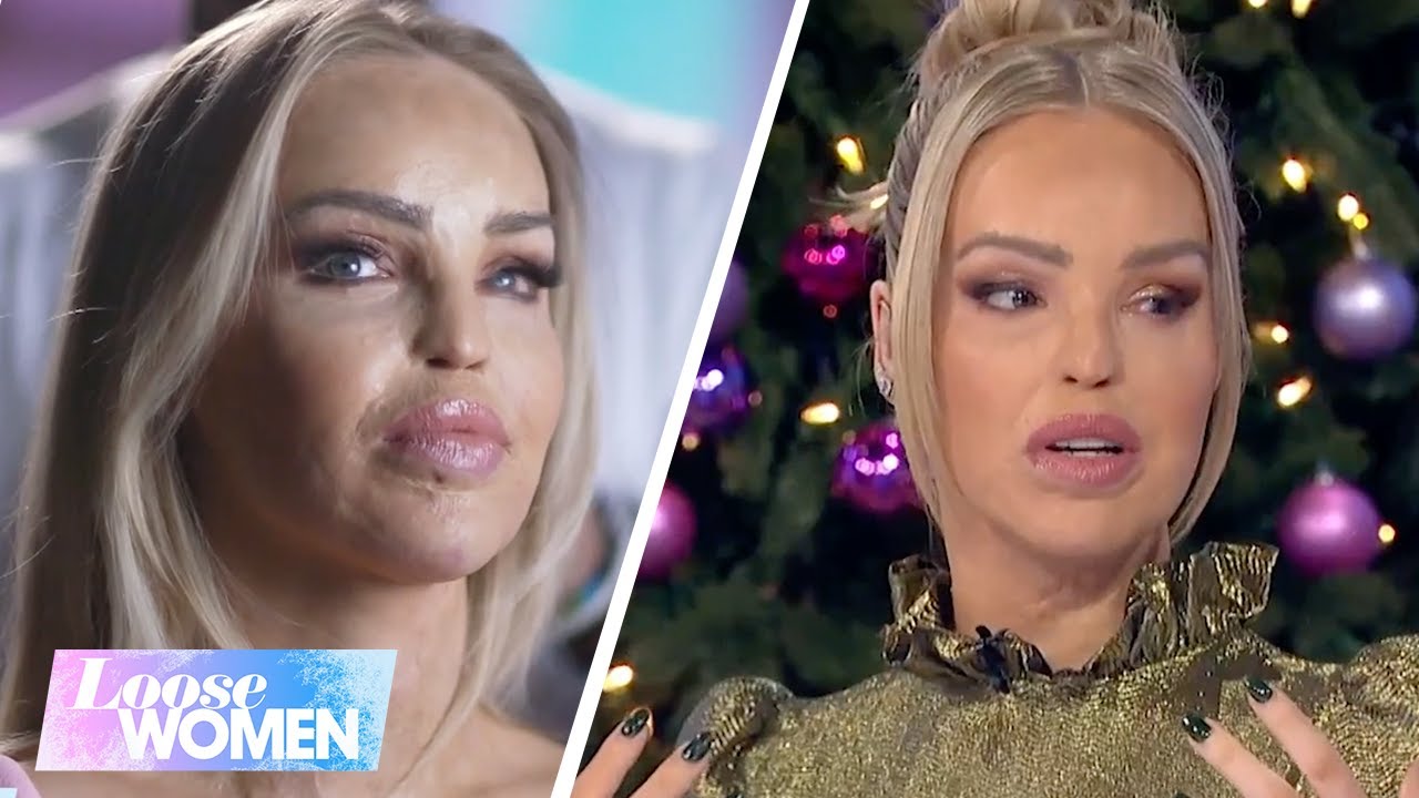 Loose Women's Katie Piper Opens Up About The Impact Of On-Screen ...