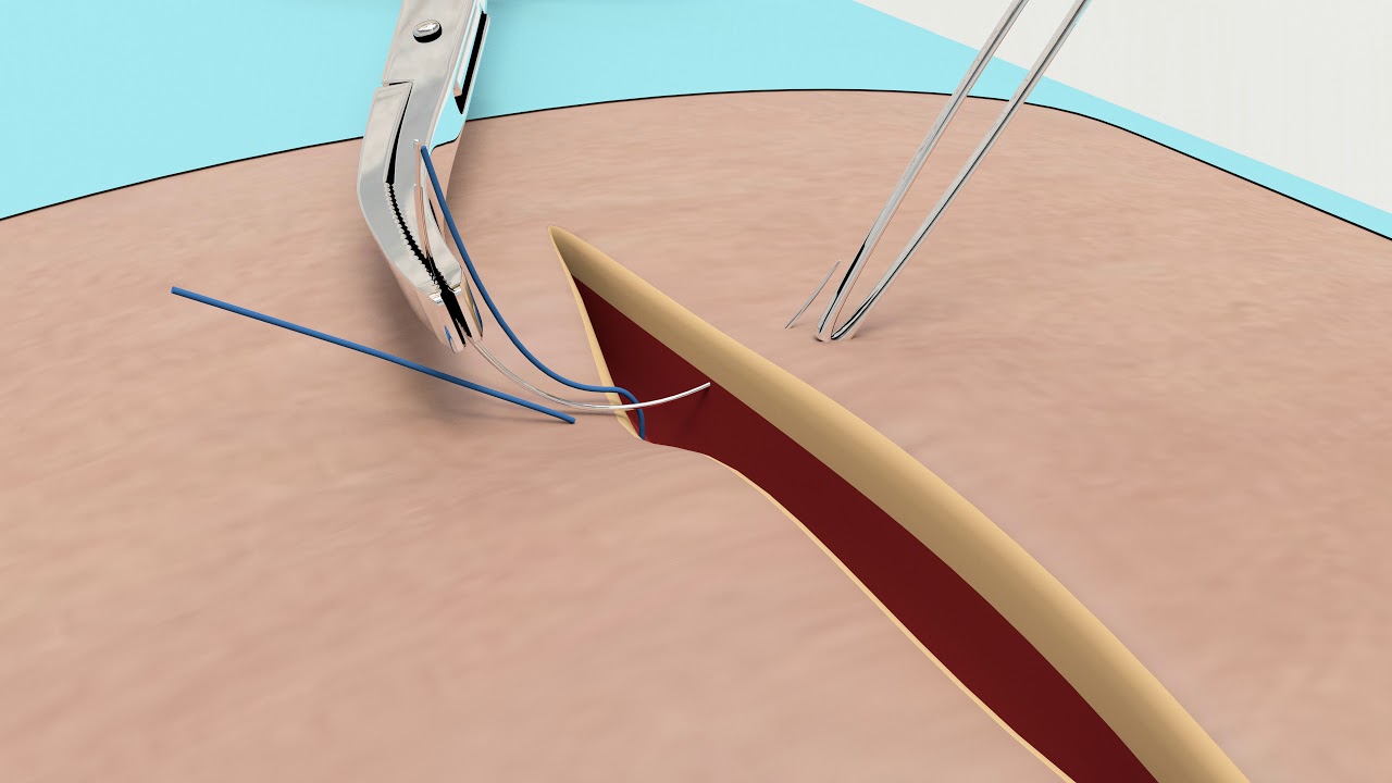 How to do stitches - YouTube