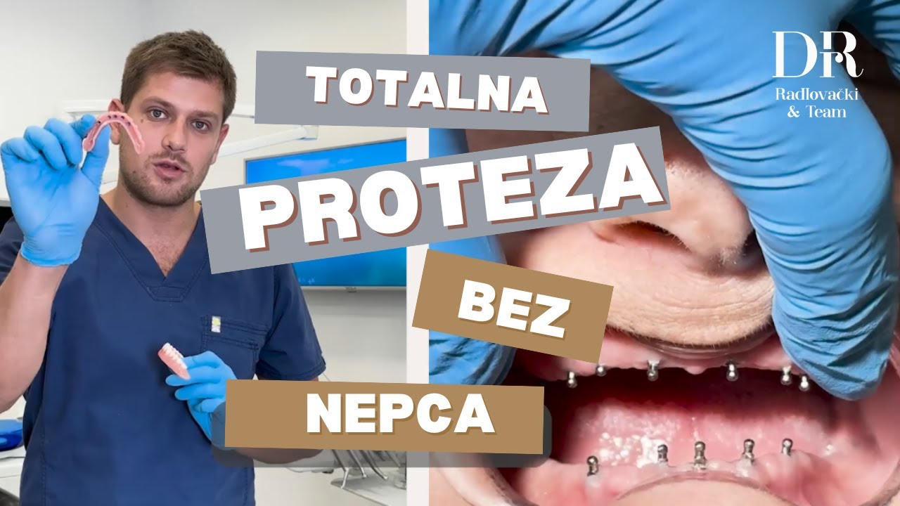 Kako Izgleda Proteza Bez Nepca? ( Na Drikere) - YouTube