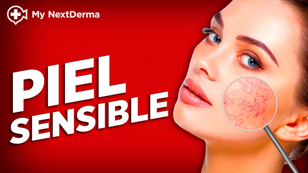 PIEL SENSIBLE. Cómo IDENTIFICARLA y Cuáles son sus CUIDADOS. - YouTube