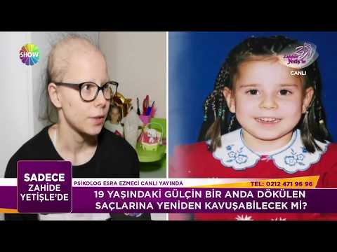 Gülçin yeniden saçlarına kavuşabilecek mi?