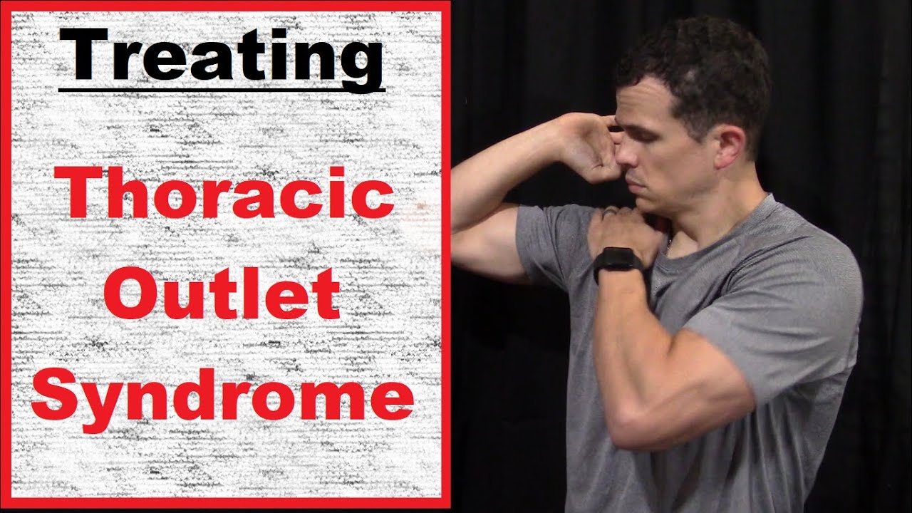 Treating Thoracic Outlet Syndrome - YouTube