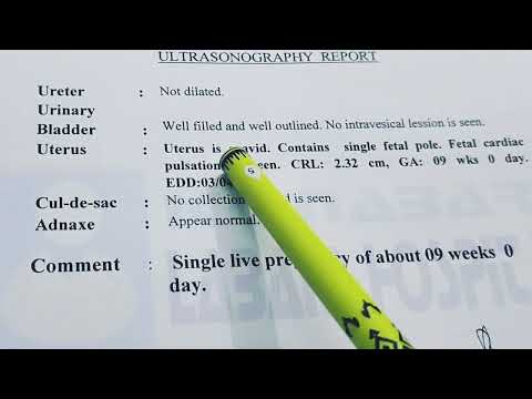 1st trimester USG report || আল্ট্রাসনোগ্রাফী রিপোর্ট বুজার নিয়ম || USG report. #pregnanacy USG ...