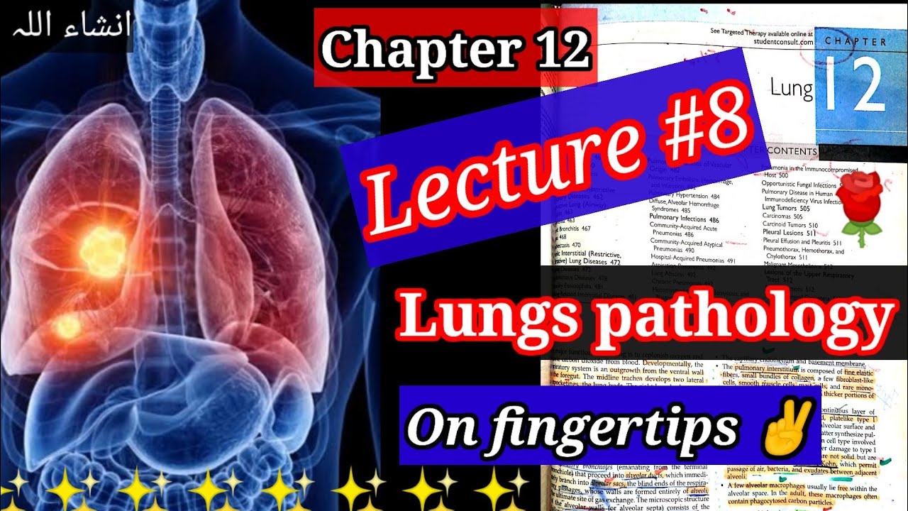 ️Respiratory pathology lecture part #8 .Obstructive Lungs and ...