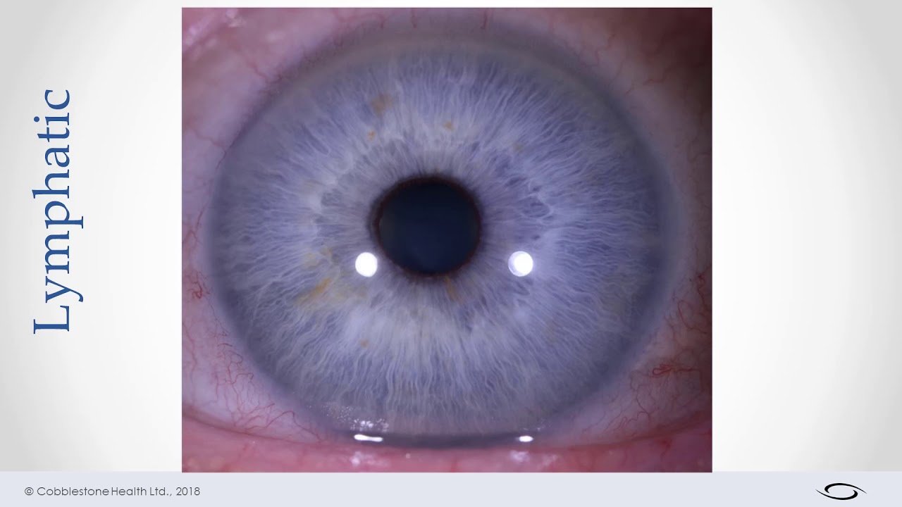 The 3 Constitutions of Constitutional Iridology: Blue eyes, Brown eyes ...