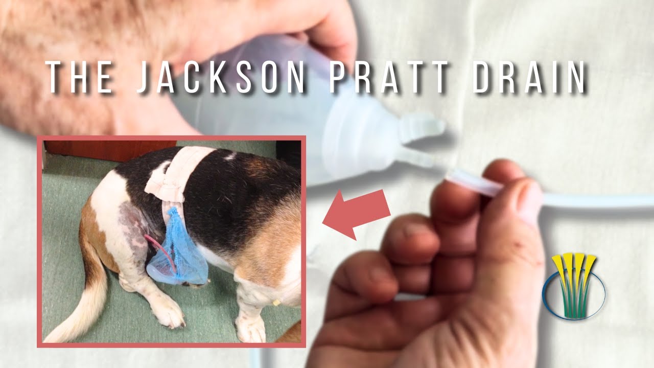 The Jackson Pratt Drain - YouTube