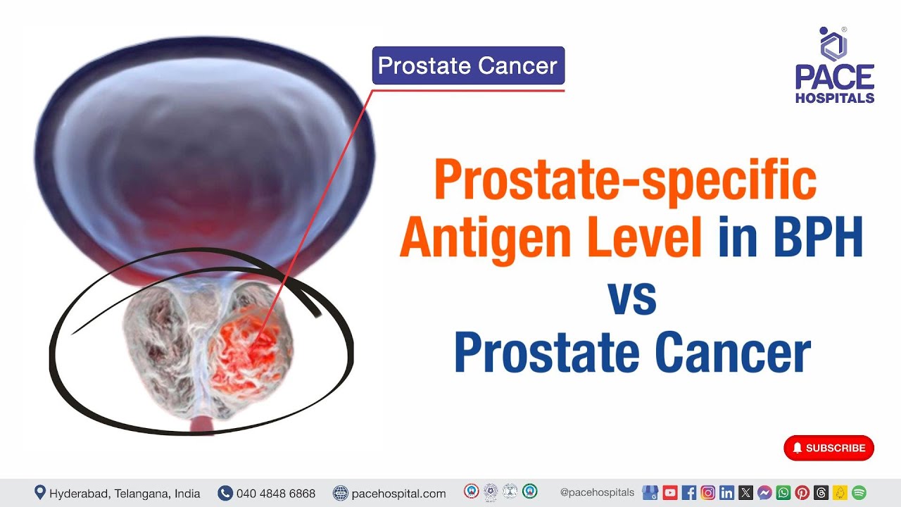 Prostate specific Antigen Level in BPH vs Prostate Cancer | # ...