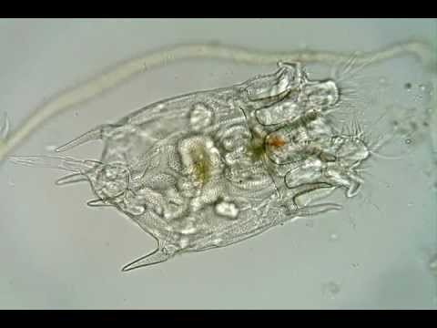 A living fortress: Plationus patulus (rotifer) - YouTube