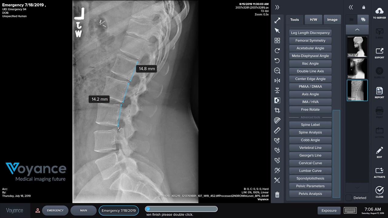 Voyance - George's line - YouTube