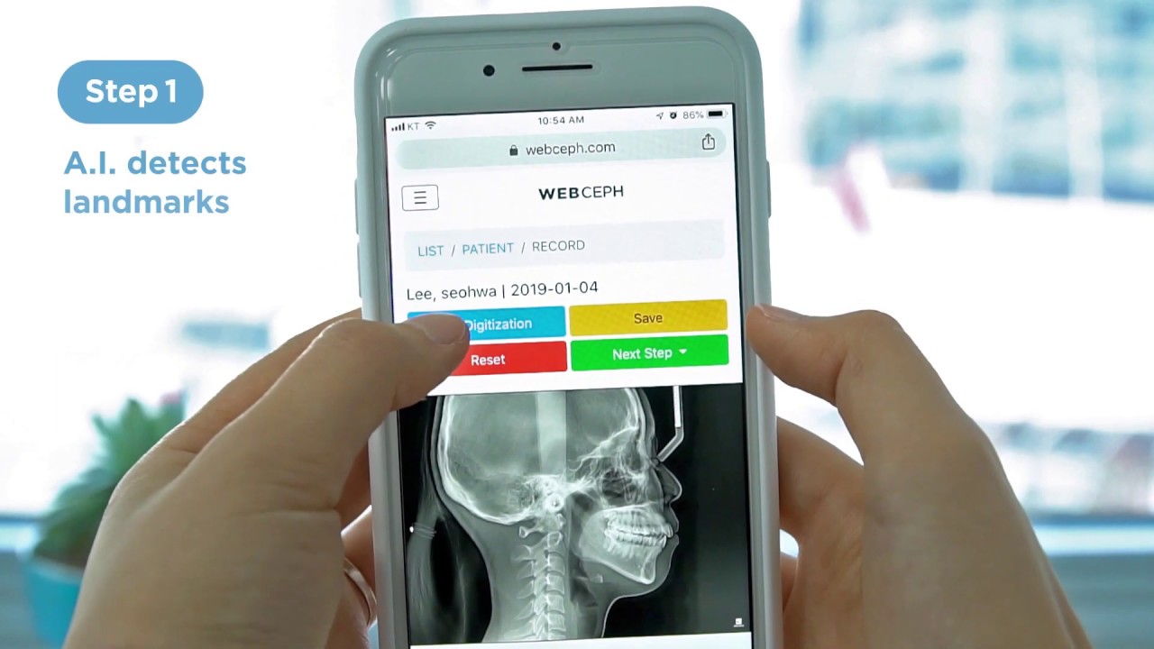 Mobile tutorial of WebCeph: Artificial-Intelligence Orthodontic ...
